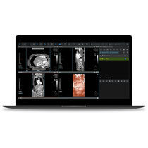 MRI software - All medical device manufacturers