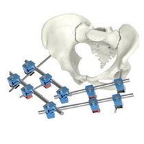 External fixation system - All medical device manufacturers