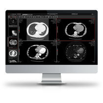 Visualization software, Viewer software - All medical device manufacturers