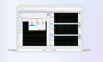 Electrocardiography software, ECG software - All medical device ...