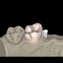 Zirkonzahn: Dental - MedicalExpo
