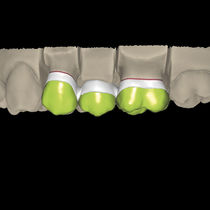 Zirkonzahn: Dental - MedicalExpo