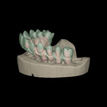 Zirkonzahn: Dental - MedicalExpo