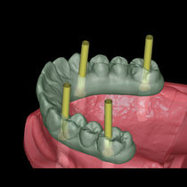 Zirkonzahn: Dental - MedicalExpo