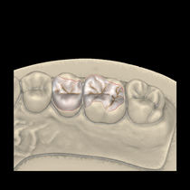 Zirkonzahn: Dental - MedicalExpo
