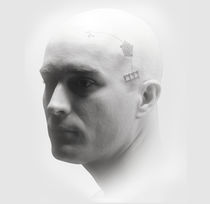 Cranial fixation system - All medical device manufacturers