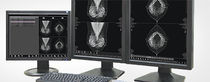 Mammography computer workstation - All medical device manufacturers