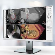 Pie Medical Imaging: Medical Imaging - MedicalExpo