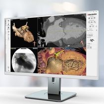 Pie Medical Imaging: Medical Imaging - MedicalExpo