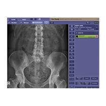 Radiography software, X-ray imaging software - All medical device ...