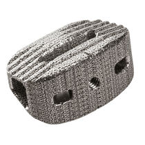 Alphatec Spine: Secondary care - MedicalExpo