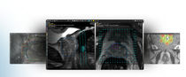 MRI software - All medical device manufacturers