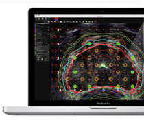 MIM Software: Medical Imaging - MedicalExpo