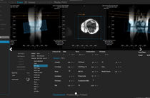 MRI software - All medical device manufacturers