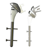 Shoulder prosthesis - All medical device manufacturers