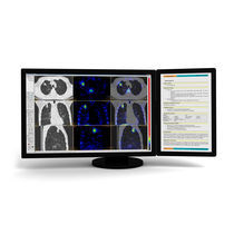Mediso: Medical Imaging - MedicalExpo