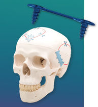 Cranial fixation system - All medical device manufacturers