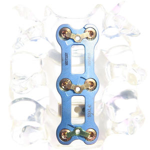 Cervical interbody fusion cage - C7™ - Medyssey Spine - anterior / PEEK