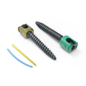 Orthopedic surgery,Other orthopedic surgery implants and devices - All ...