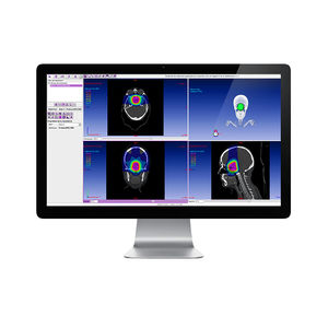 Radiation therapy software - IMAgo - DOSIsoft - contour detection
