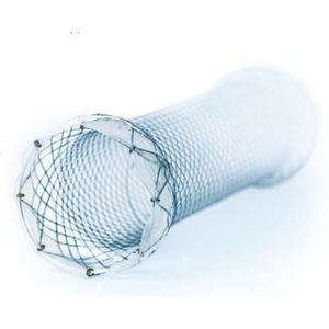 Gastric stent - ST01 - Luda Medica - nitinol / self-expanding
