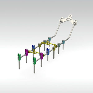 Thoraco-lumbar osteosynthesis unit - SSS4 - TASARIMMED - posterior / adult