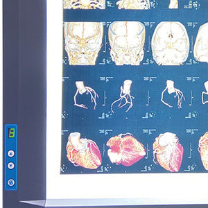 Digital X-ray film viewer - All medical device manufacturers