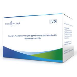 Cervical cancer test kit - HWTS-CC005A - Jiangsu Macro micro-test ...