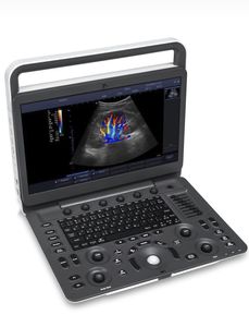 Portable ultrasound system - X3 - Beijing iTrason Technologies - for ...