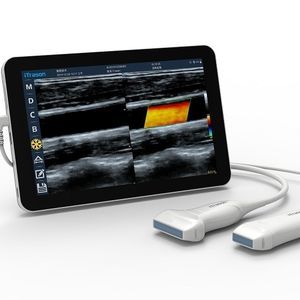 Hand-held ultrasound system - Lite31P - Beijing iTrason Technologies ...