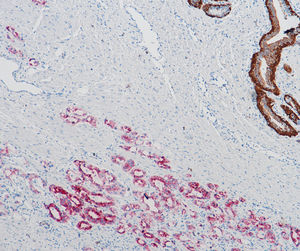 Stain reagent kit - SD8005 - Celnovte Biotechnology Co., Ltd. - tissue ...