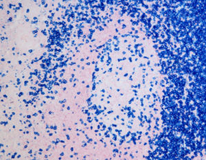 Stain reagent kit - SD8005 - Celnovte Biotechnology Co., Ltd. - tissue ...