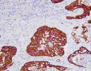 Staining solution reagent kit - SD8001 - Celnovte Biotechnology Co ...