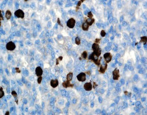 Stain reagent - CEM-0033 - Celnovte Biotechnology Co., Ltd. - staining ...