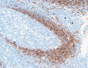 Stain reagent - CCM-0461 - Celnovte Biotechnology Co., Ltd. - staining ...