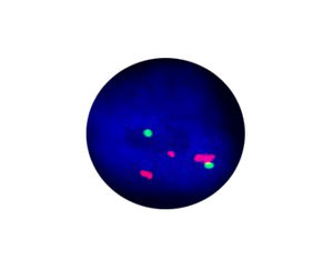 EML4-ALK fusion gene test kit - CF1012 - Celnovte Biotechnology Co ...