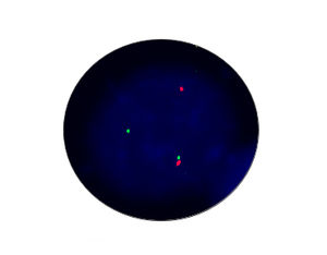 EML4-ALK fusion gene test kit - CF1012 - Celnovte Biotechnology Co ...