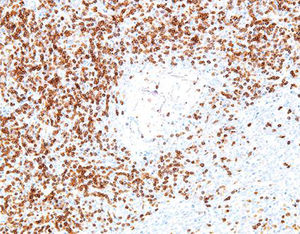 Stain reagent - CCM-0983 - Celnovte Biotechnology Co., Ltd. - antibody ...