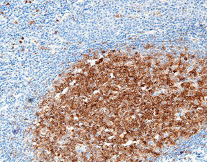 Staining solution reagent - CPR-0221 - Celnovte Biotechnology Co., Ltd ...