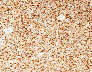 Staining solution reagent - CPR-0221 - Celnovte Biotechnology Co., Ltd ...