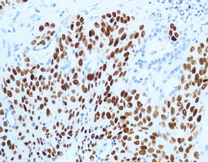 Stain reagent - CCM-0461 - Celnovte Biotechnology Co., Ltd. - staining ...