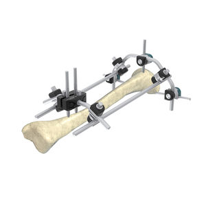 Tibia external fixation system - Wuxi Betta Medical Technology ...