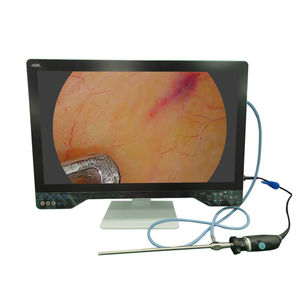 Surgical camera - Shenzhen Tuyou Medical Imaging Co., Ltd. - digital ...