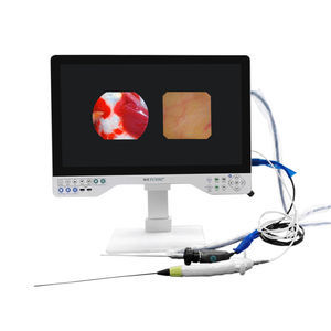 Medical video camera - Shenzhen Tuyou Medical Imaging Co., Ltd ...