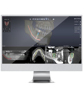 Dental surgery surgical navigation system - Neo NaviGuide - Neobiotech ...
