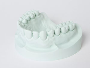 Plaster dental material - Vantago - Dentona AG - modeling