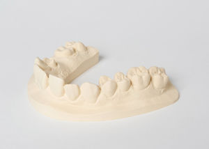 Stone dental material - esthetic-rock® 285 - Dentona AG - modeling