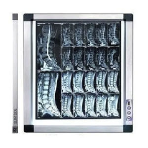 Digital X-ray film viewer - MV-FV2 - Mediveron - 1-screen / LED ...