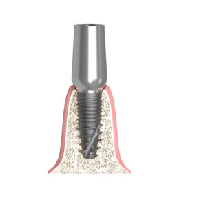 Cylindrical implant abutment - Biolevel - Bionika Medline Kft ...