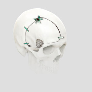 Non-absorbable cranial fixation system - LEFORTE 0.6 - Jeil Medical ...